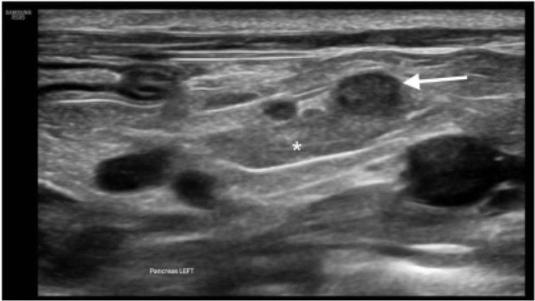 Pancreatic Disease in Exotic Pets: Why Ferrets Are Different and What ...