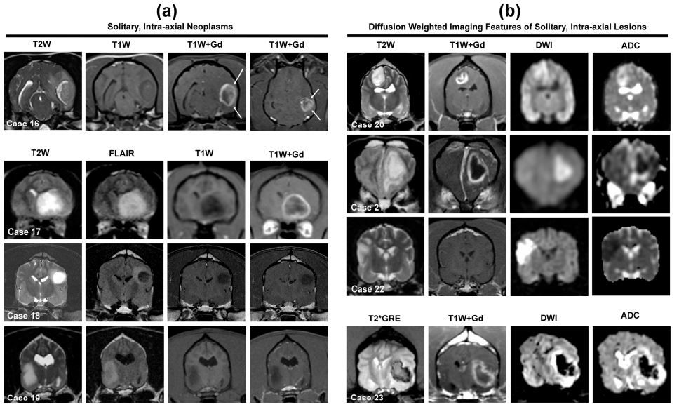 Scoping review-all that is known about MRI characteristics of Brain ...