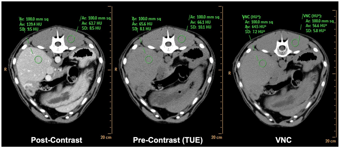 Can we generate a non-contrast CT image from a contrast one.