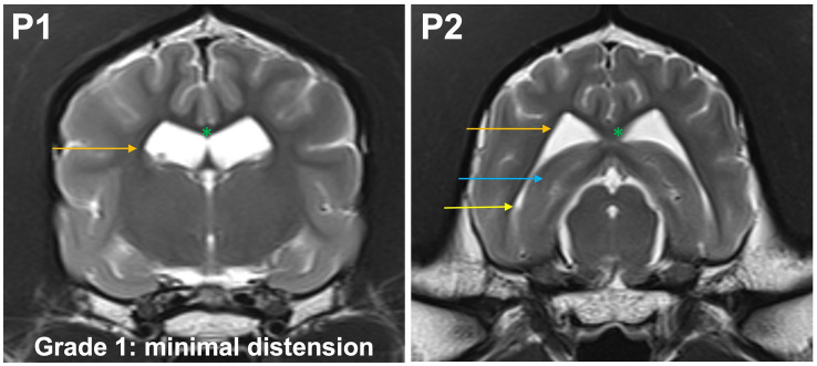 A proposed grading scheme for ventricular distention in dogs