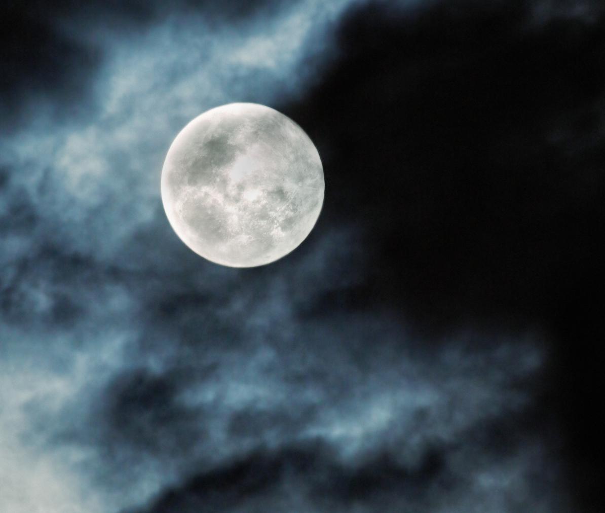 'Werewolf Syndrome' In Babies Is On The Rise