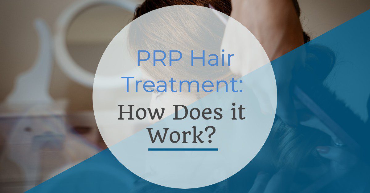 What is PRP Hair Treatment and How Does it Work?